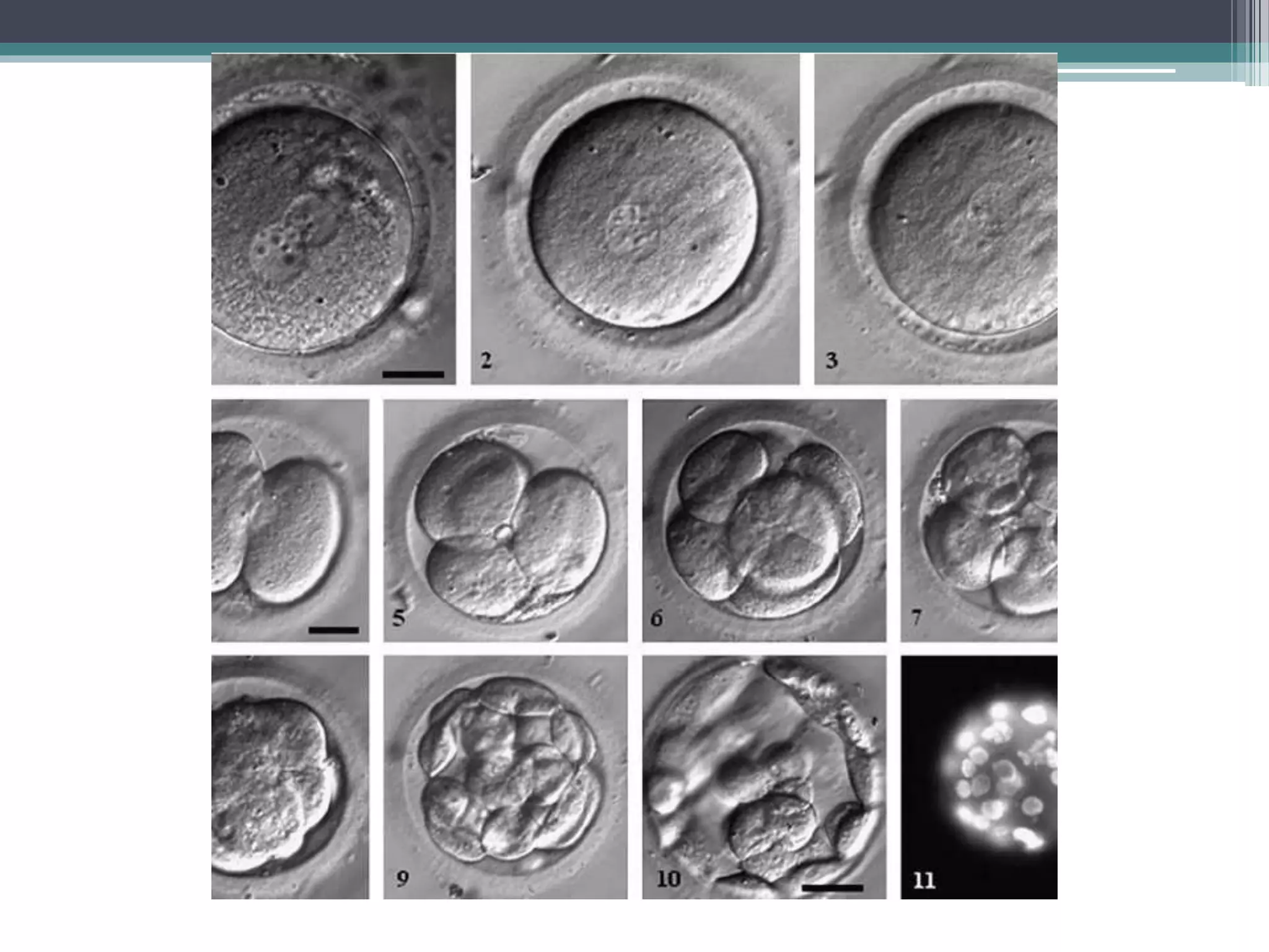 Invitro fertilization in humans(IVF) | PPTX