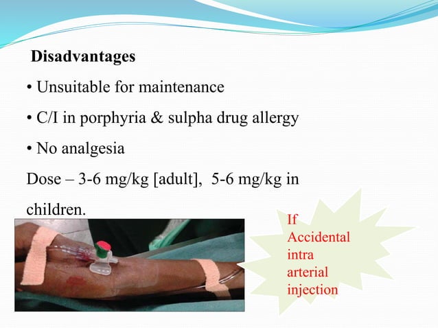 IV induction agent | PPTX