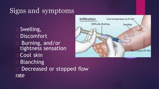 IV infiltration and Extravasation | PPTX
