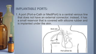 Iv infusion | PPT