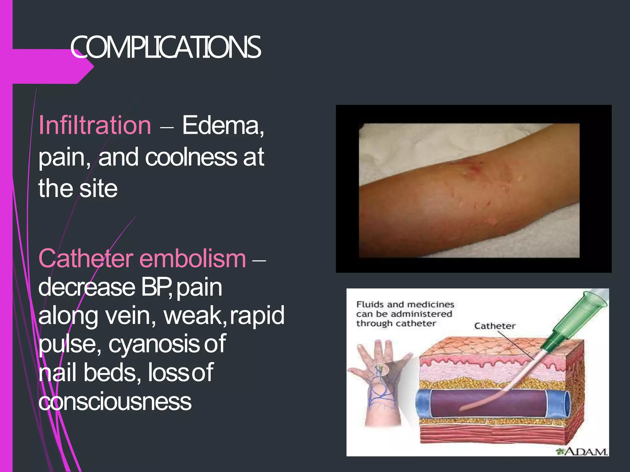 Iv infusion ppt | PPTX