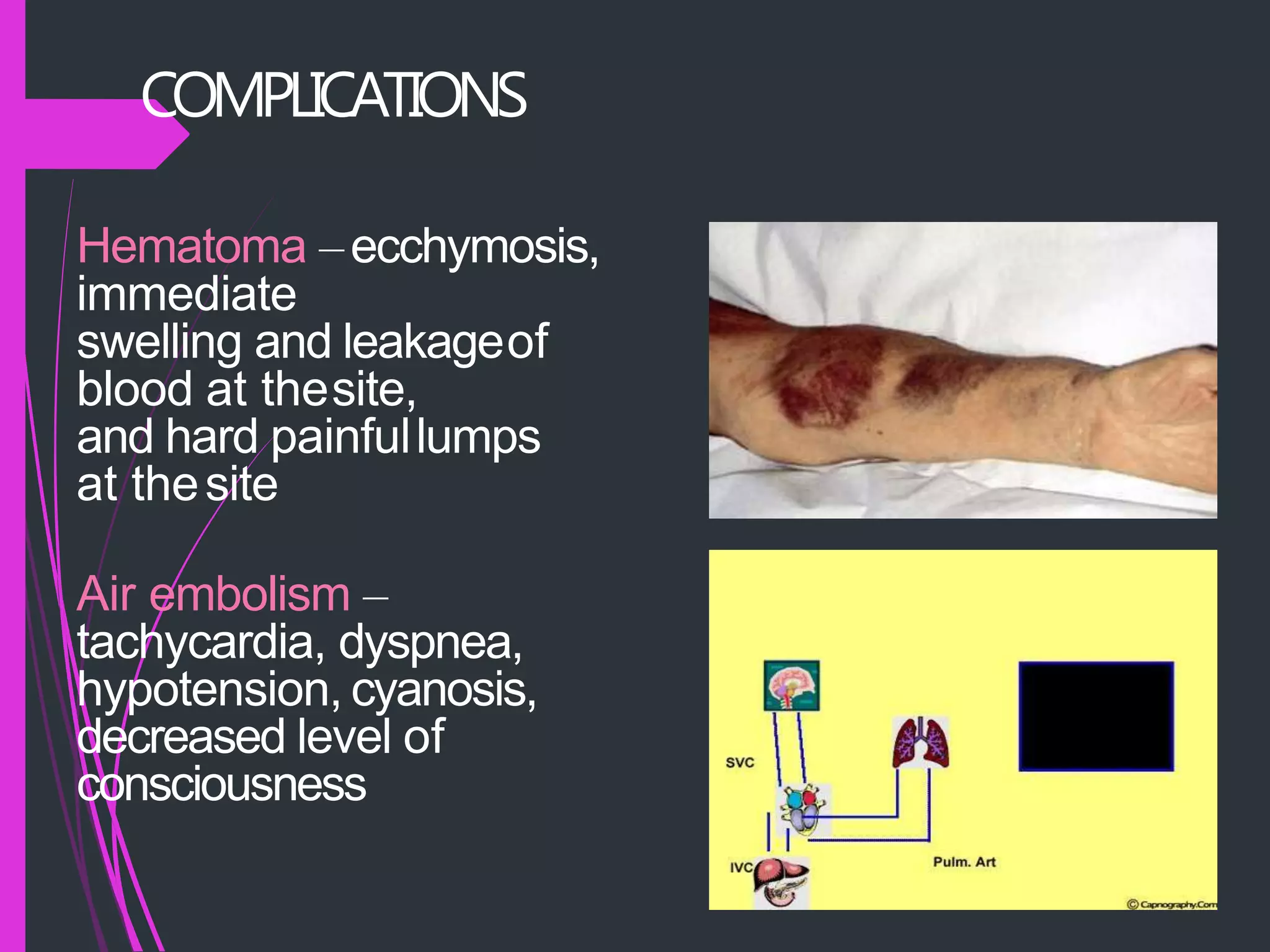 Iv infusion ppt | PPTX