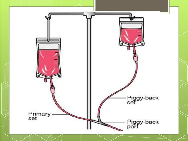 Iv infusion ppt | PPTX