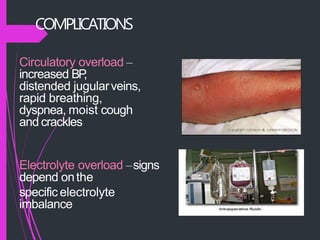 Iv infusion ppt | PPTX