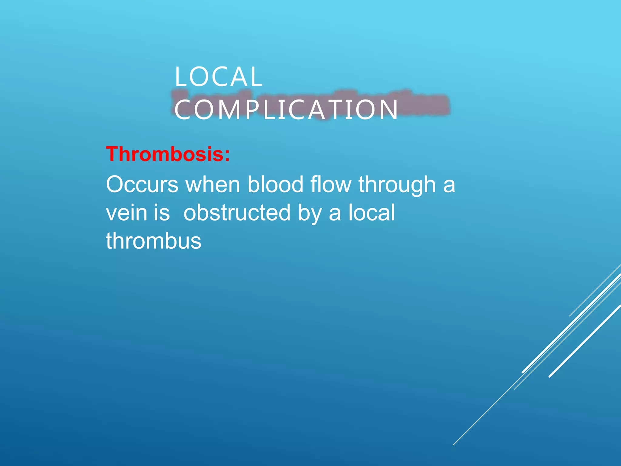 Intravenous Injection ppt | PPTX