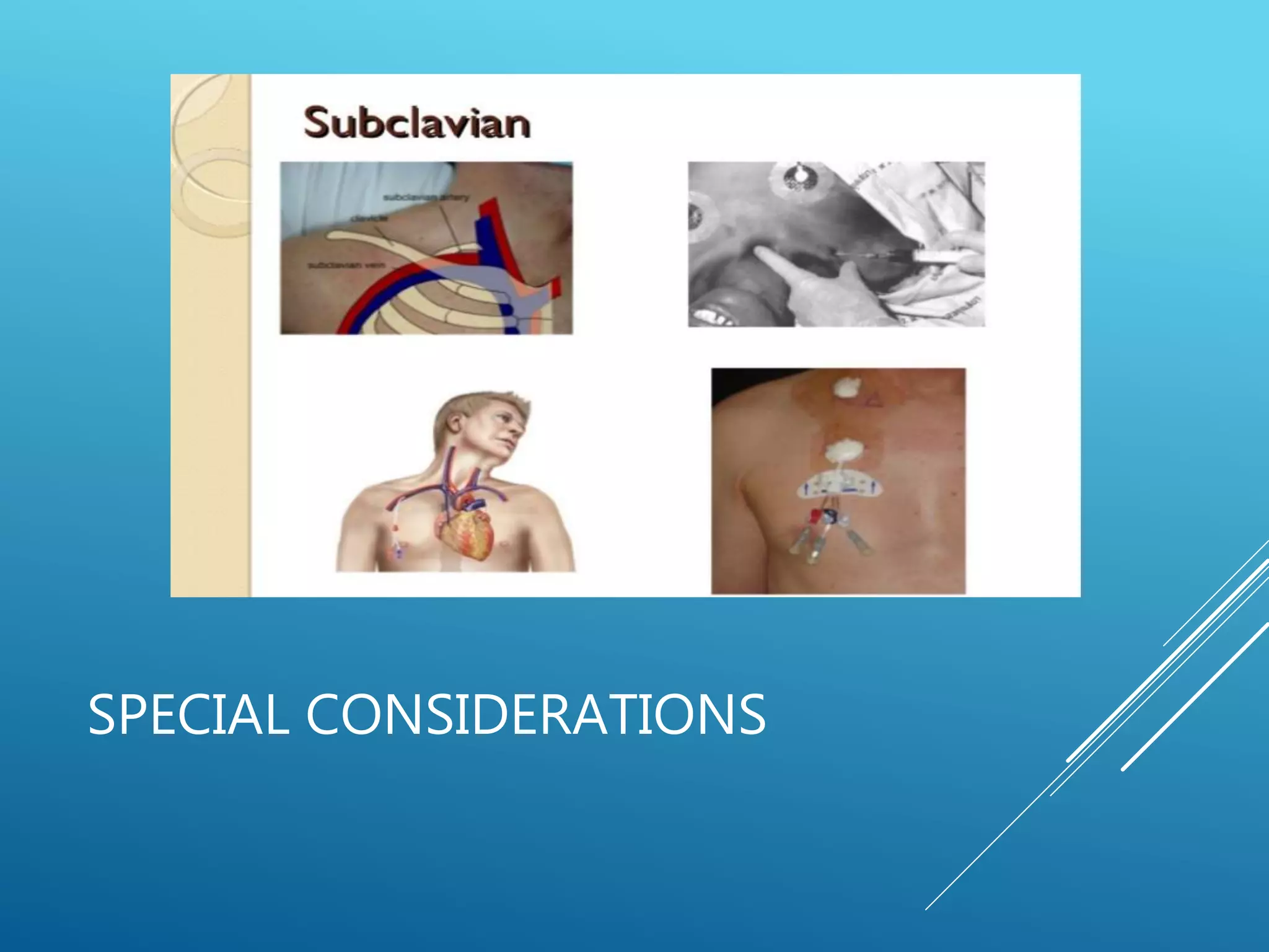 Intravenous Injection ppt | PPTX