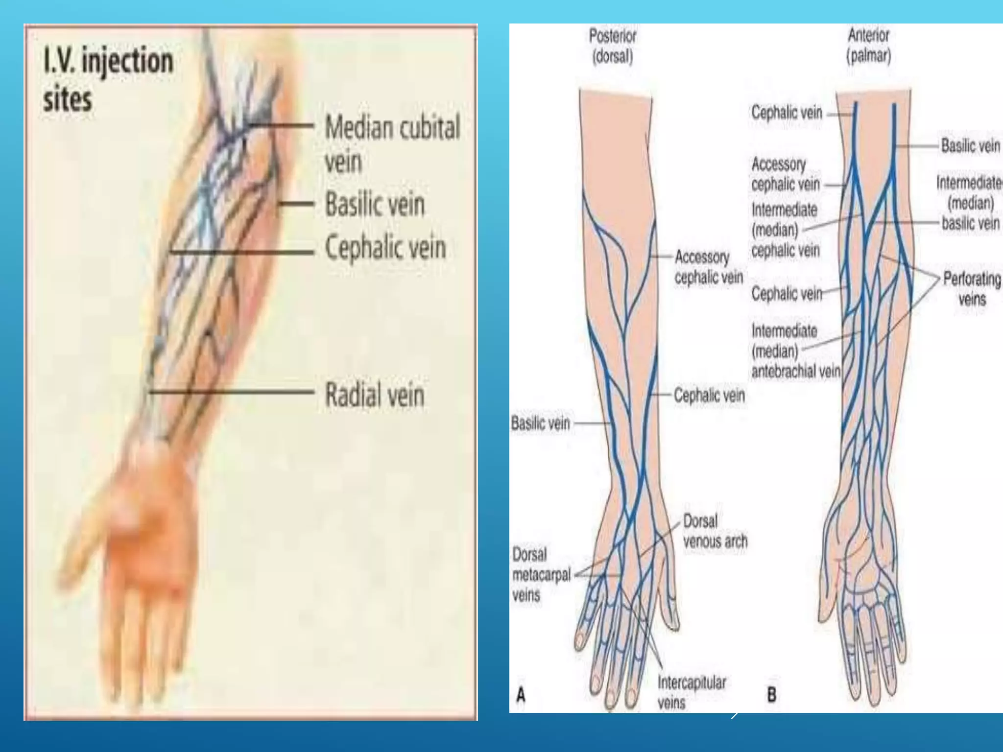Intravenous Injection ppt | PPTX