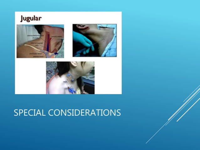 Intravenous Injection ppt | PPTX