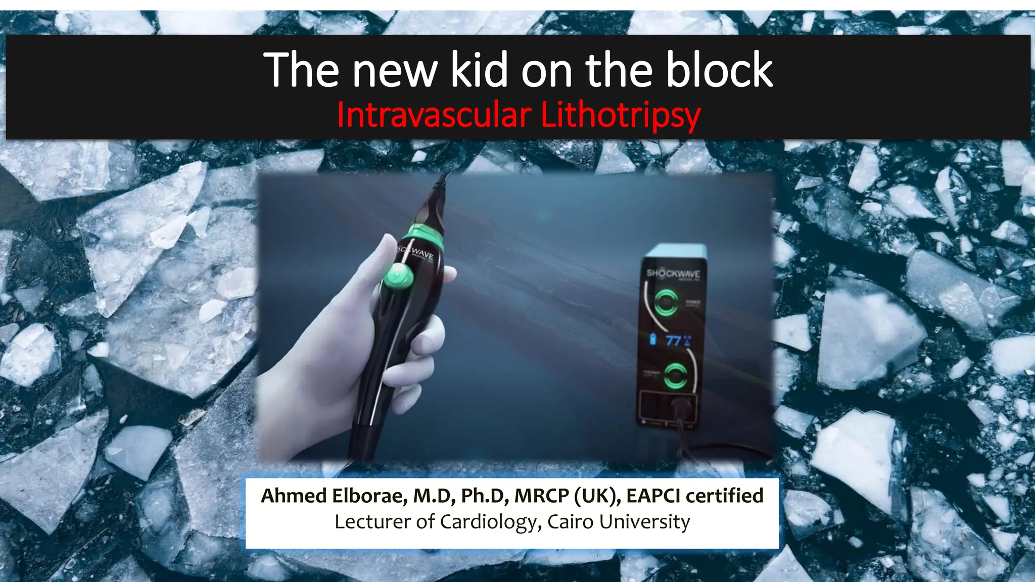 Coronary shock wave lithotripsy balloon (IVL) | PDF