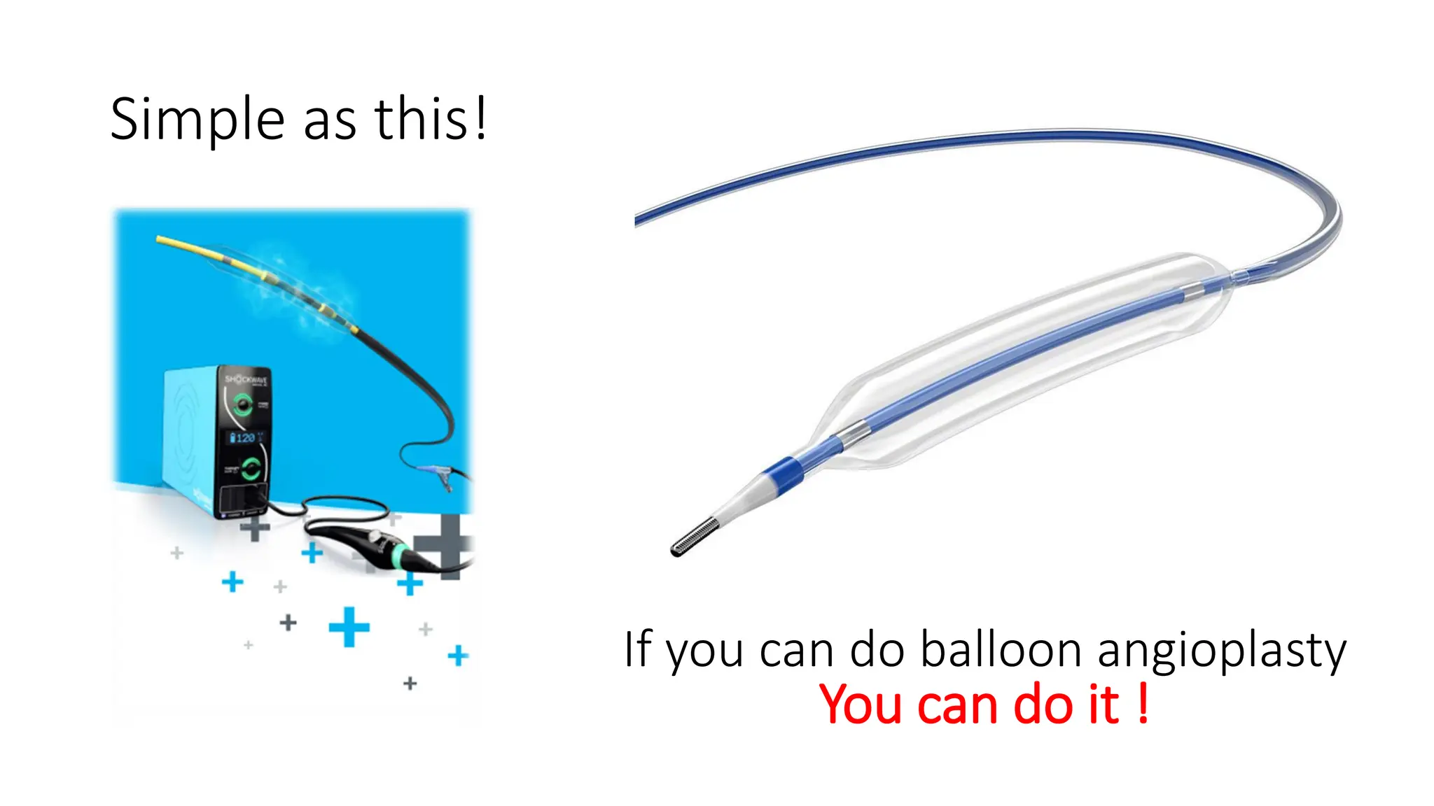 Coronary shock wave lithotripsy balloon (IVL) | PDF