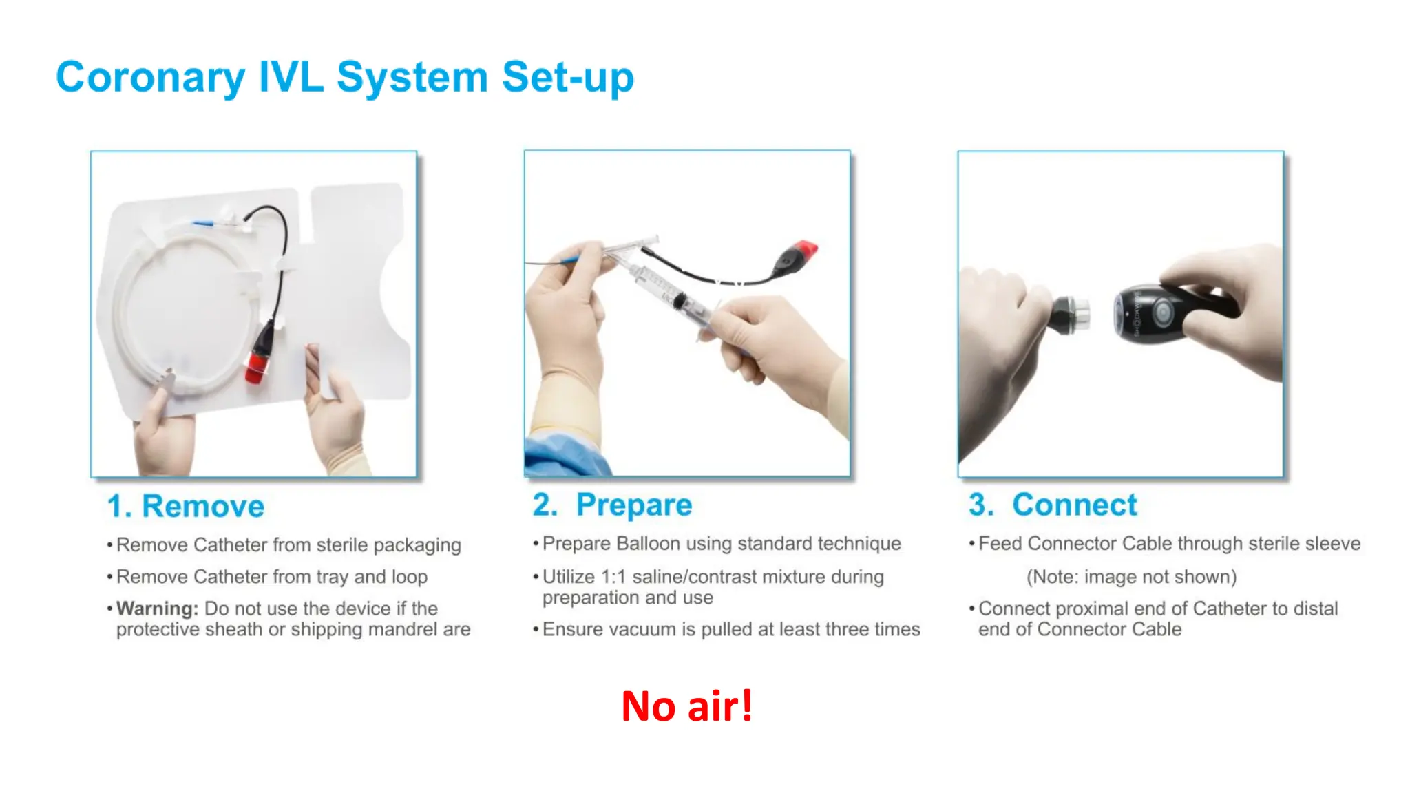 Coronary shock wave lithotripsy balloon (IVL) | PDF