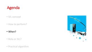 Coronary shock wave lithotripsy balloon (IVL) | PDF