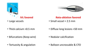 Coronary shock wave lithotripsy balloon (IVL) | PDF