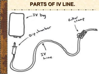 Iv line. | PPT
