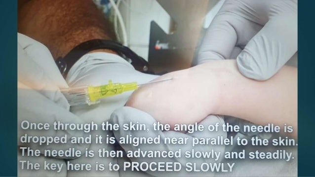 Iv line insertion in children | PPTX