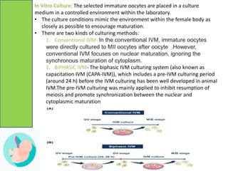 IVM (In vitro oocyte maturation).pptx