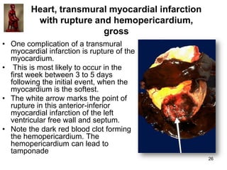 IVMS-CV-Cardiovascular Pathology | PDF
