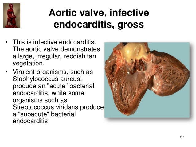 IVMS-CV-Cardiovascular Pathology