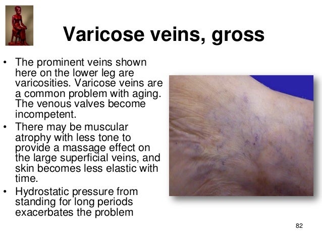IVMS-CV-Cardiovascular Pathology