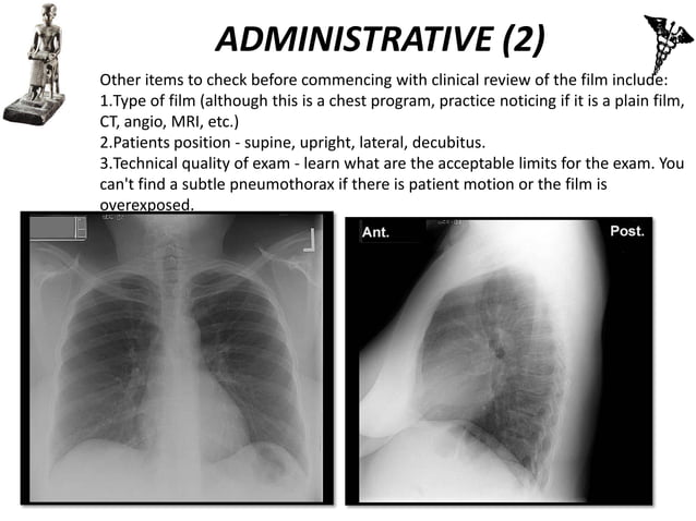 Basic CXR Interpretation_Diagnostic Radiography | PDF
