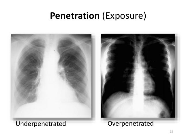 Basic CXR Interpretation_Diagnostic Radiography