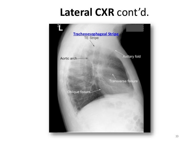 Basic CXR Interpretation_Diagnostic Radiography