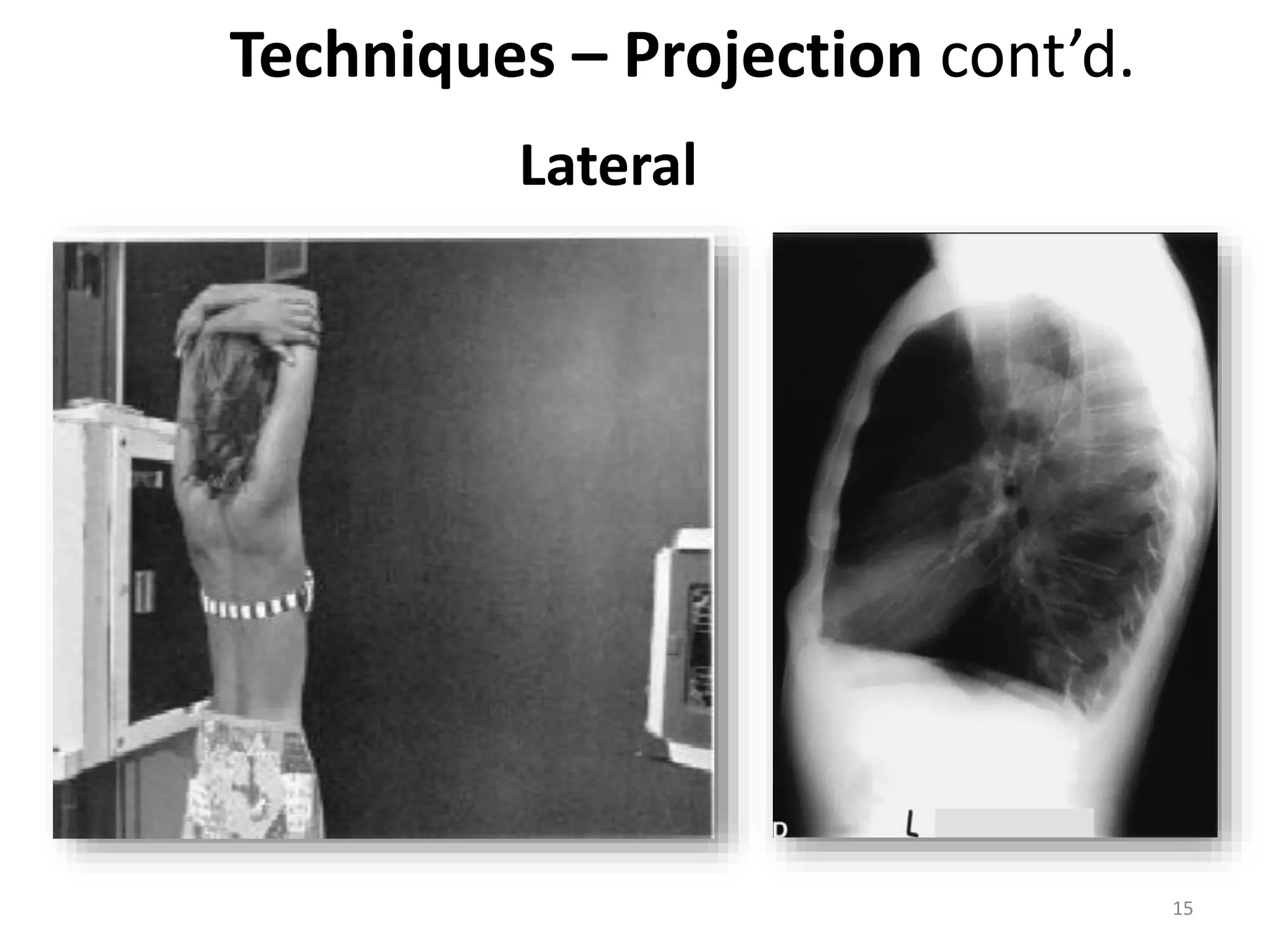 Basic CXR Interpretation_Diagnostic Radiographs | PDF