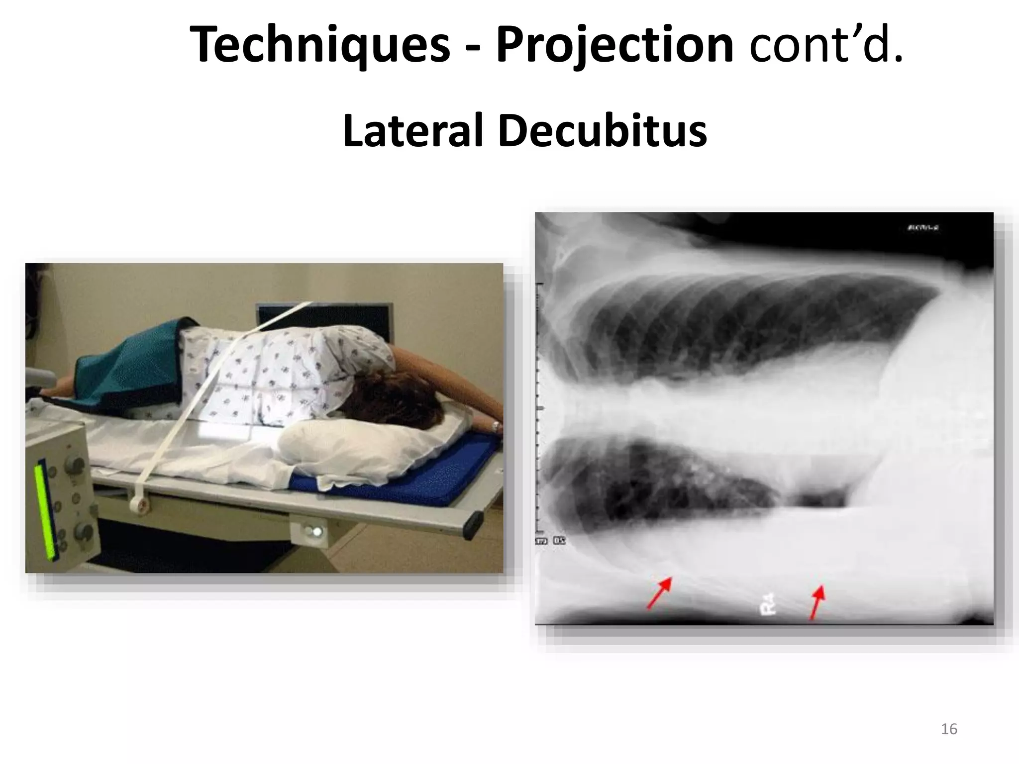 Basic CXR Interpretation_Diagnostic Radiographs | PDF