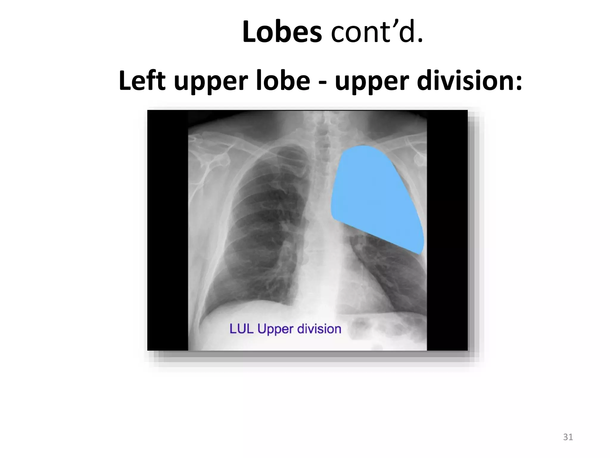 Basic CXR Interpretation_Diagnostic Radiographs | PDF