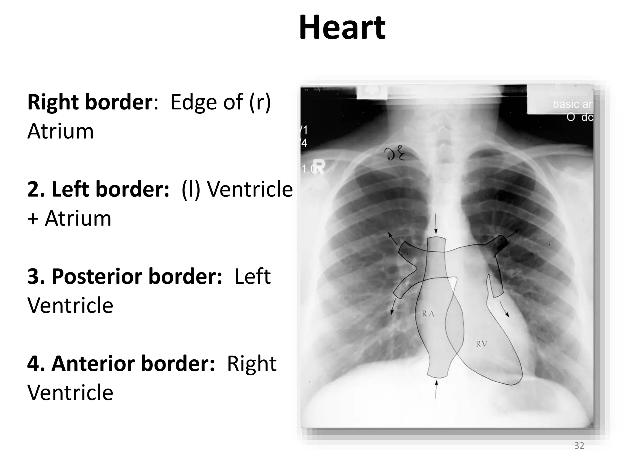 Basic CXR Interpretation_Diagnostic Radiographs | PDF