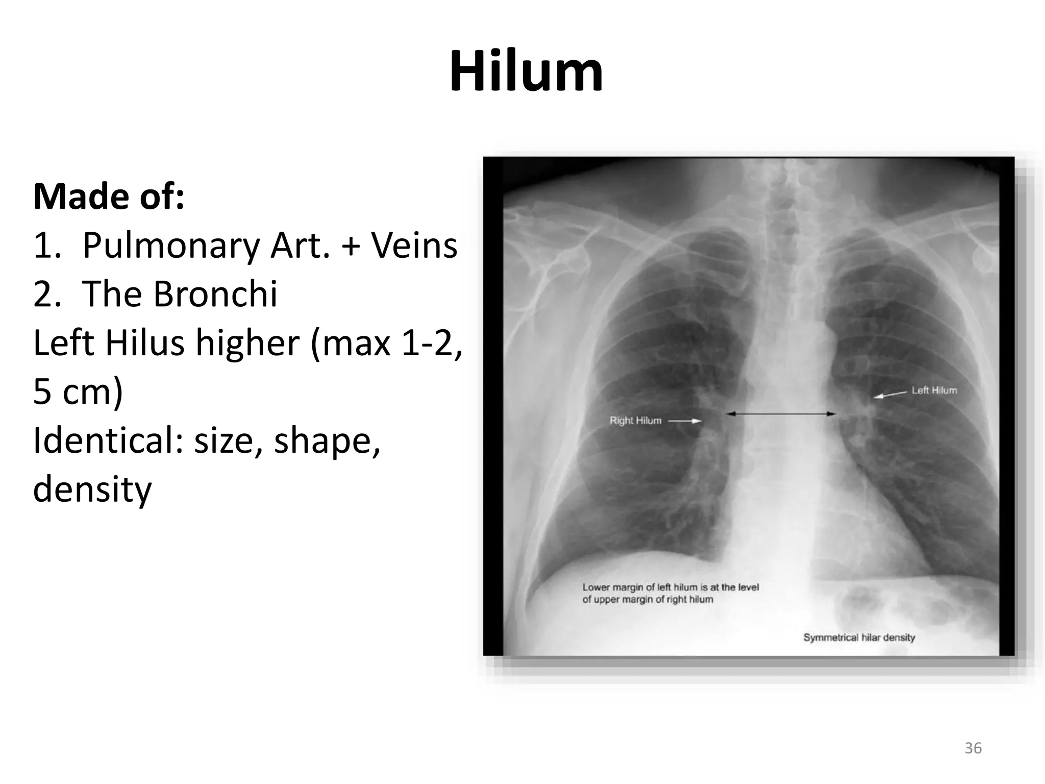 Basic CXR Interpretation_Diagnostic Radiographs | PDF