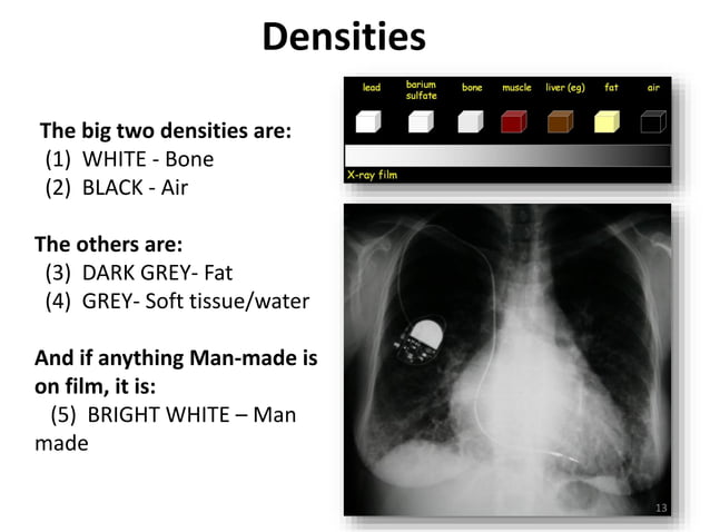 Basic CXR Interpretation_Diagnostic Radiographs | PDF
