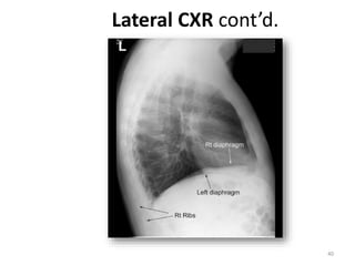 Basic CXR Interpretation_Diagnostic Radiographs | PDF