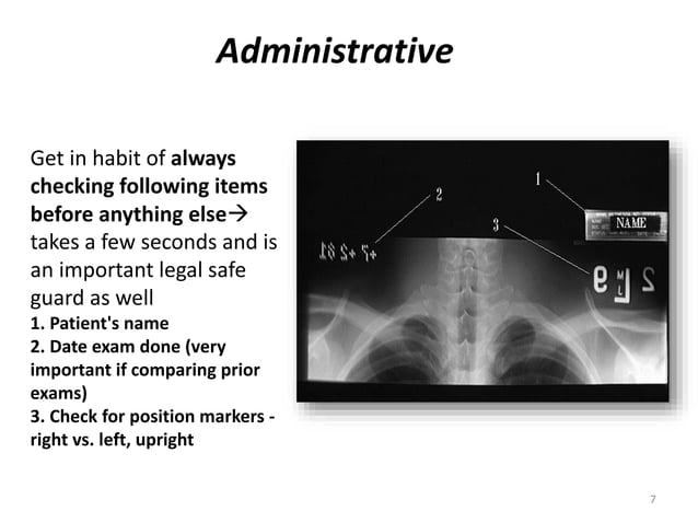 Basic CXR Interpretation_Diagnostic Radiographs | PDF