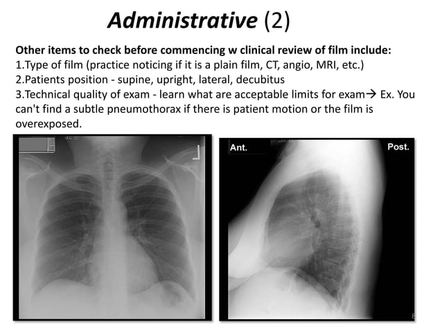 Basic CXR Interpretation_Diagnostic Radiographs | PDF
