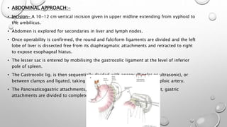 Ivor lewis esophagectomy | PPTX
