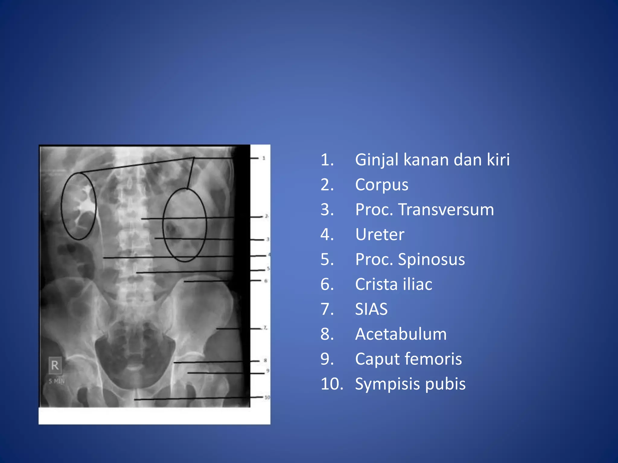 ppt kritisi dan evaluasi radiograf IVP dan cystografi | PPTX