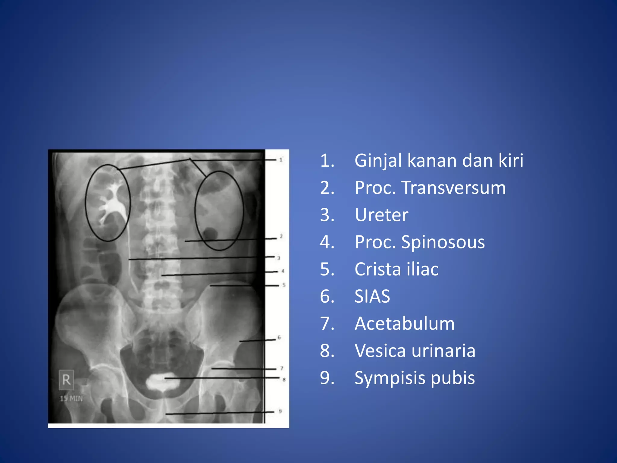 ppt kritisi dan evaluasi radiograf IVP dan cystografi | PPTX