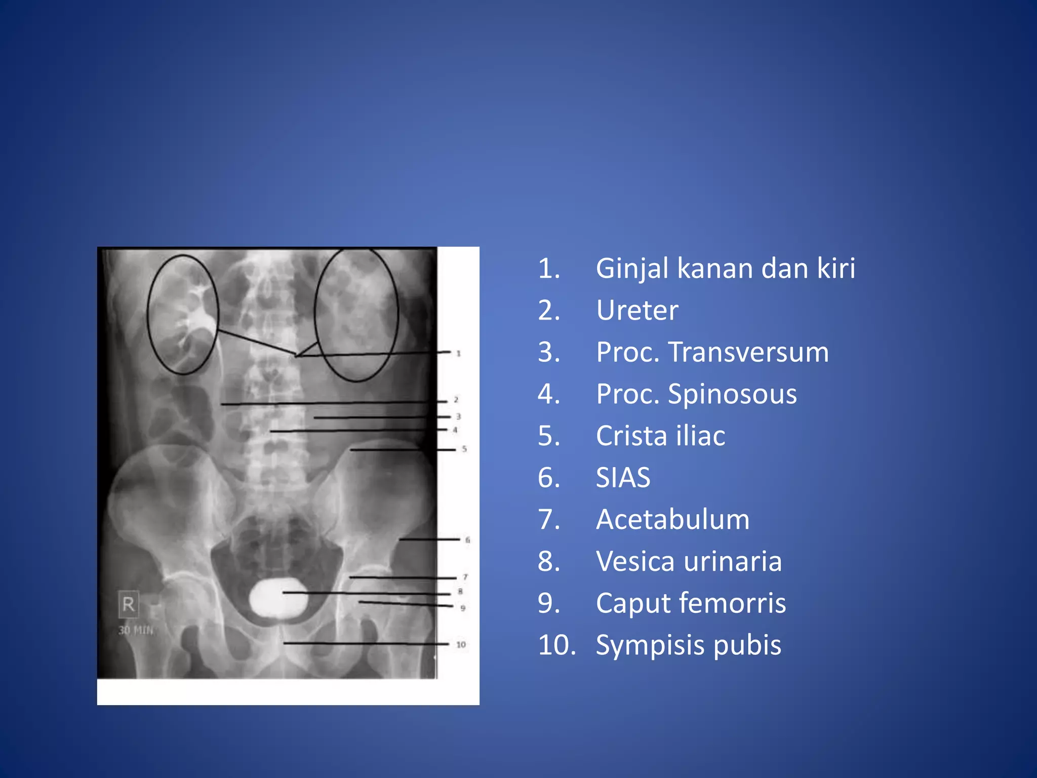 ppt kritisi dan evaluasi radiograf IVP dan cystografi | PPTX