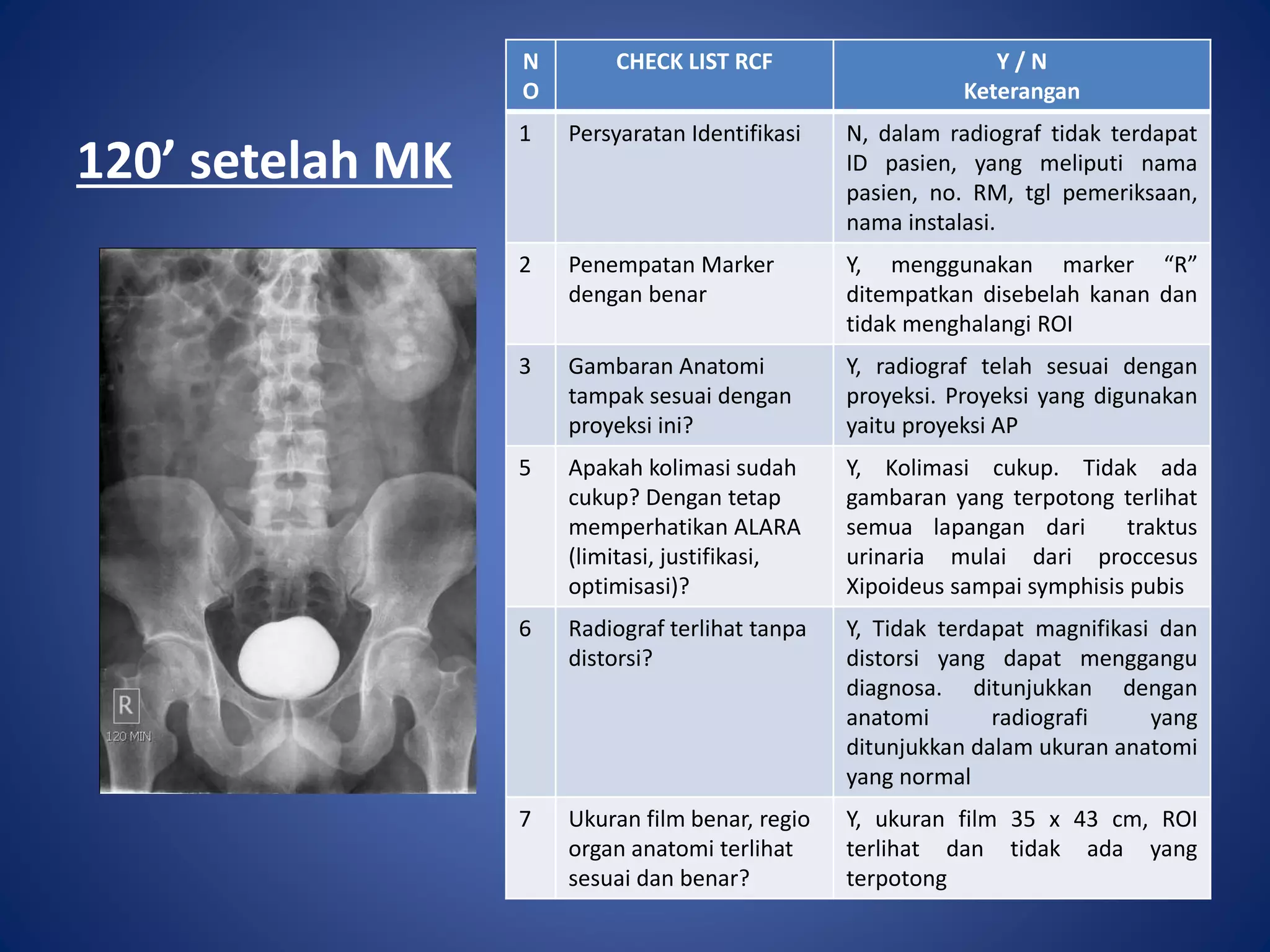 ppt kritisi dan evaluasi radiograf IVP dan cystografi | PPTX