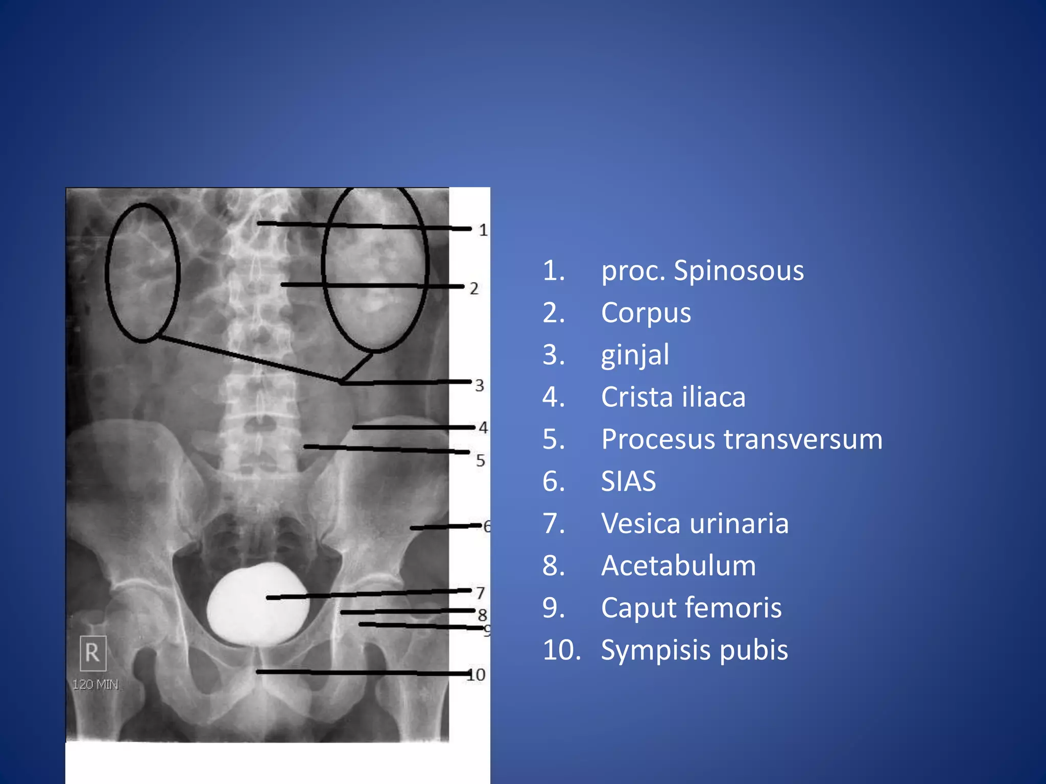 ppt kritisi dan evaluasi radiograf IVP dan cystografi | PPTX