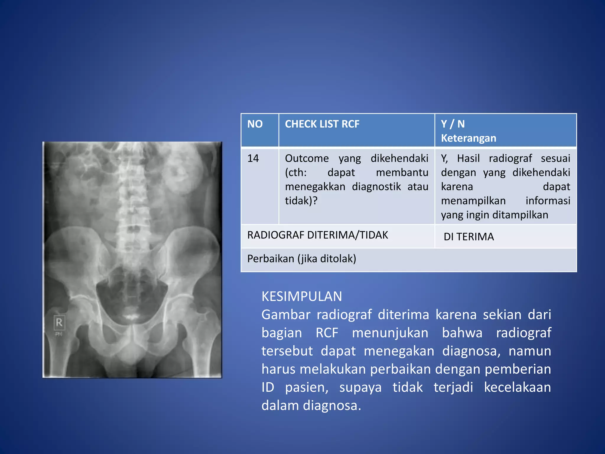 ppt kritisi dan evaluasi radiograf IVP dan cystografi | PPTX