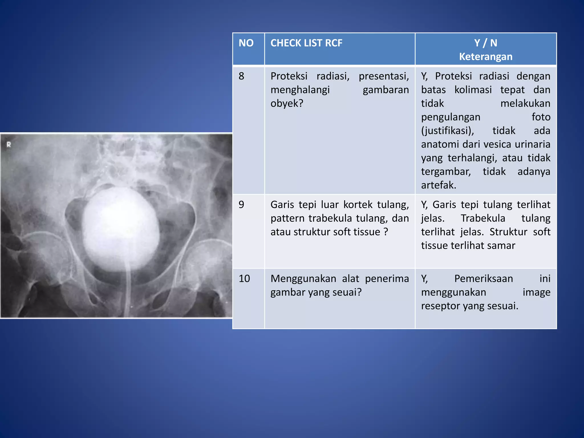 ppt kritisi dan evaluasi radiograf IVP dan cystografi | PPTX