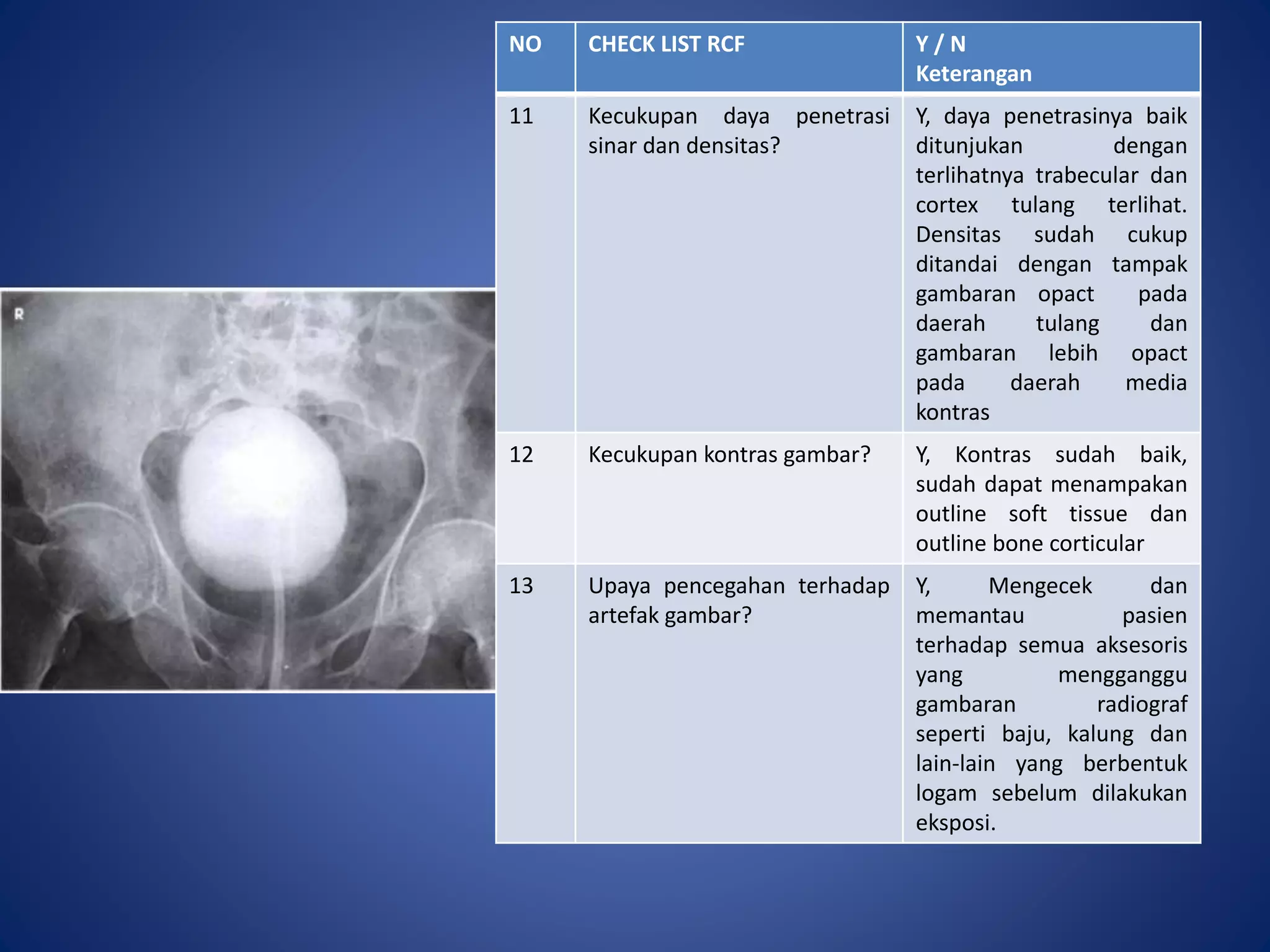 ppt kritisi dan evaluasi radiograf IVP dan cystografi | PPTX