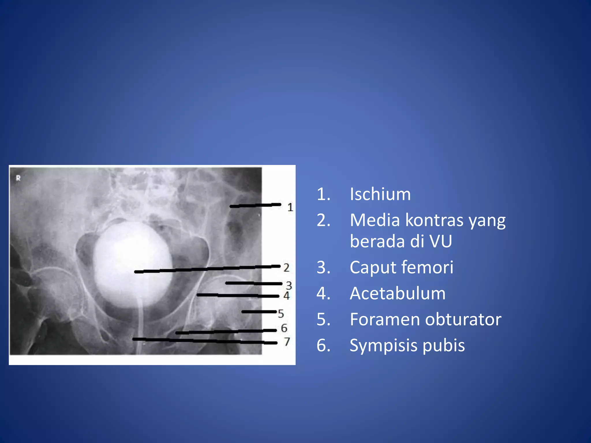 ppt kritisi dan evaluasi radiograf IVP dan cystografi | PPTX