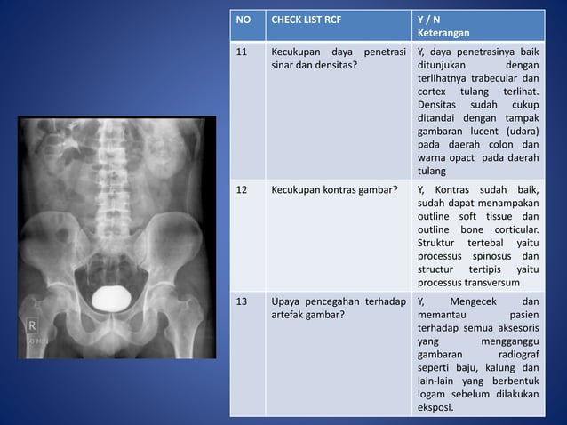 ppt kritisi dan evaluasi radiograf IVP dan cystografi | PPTX