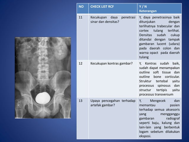 ppt kritisi dan evaluasi radiograf IVP dan cystografi | PPTX