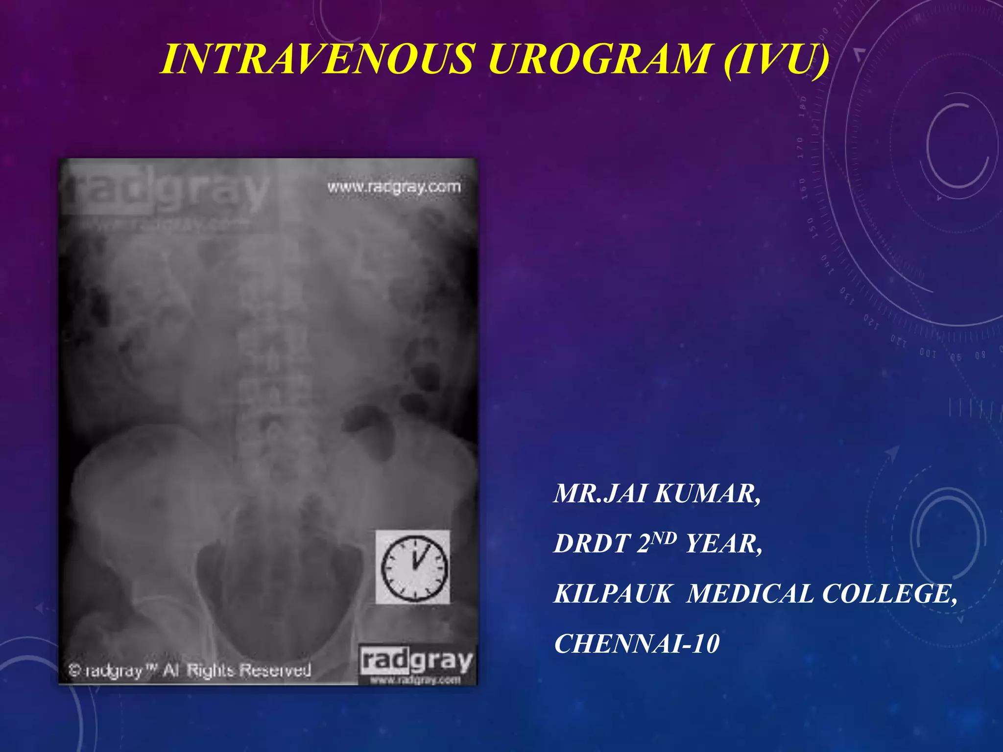 INTRAVENOUS UROGRAM (IVU) | PPTX