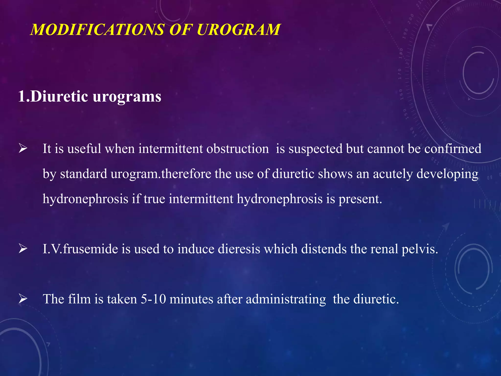 INTRAVENOUS UROGRAM (IVU) | PPTX