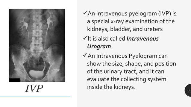 Ivp presentation for urology ward | PDF | Digestive Disorders ...
